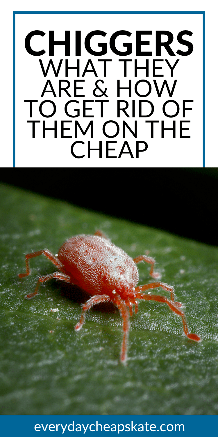 Chiggers Treatment: How to Get Rid of Them Quickly • Everyday Cheapskate
